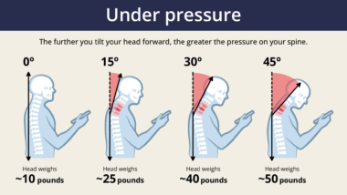 What is tech neck? | My Vanderbilt Health