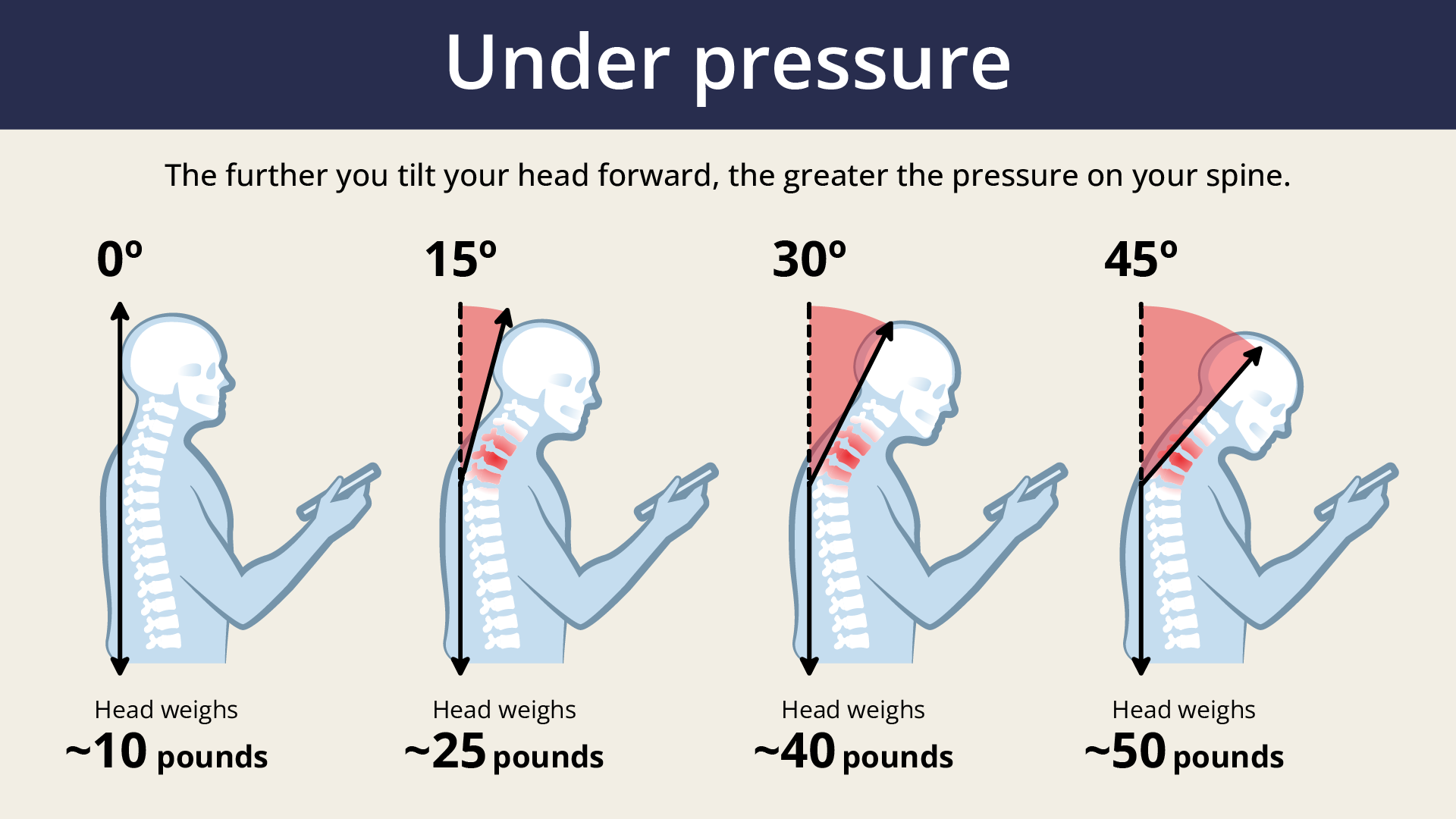 What is tech neck? | My Vanderbilt Health